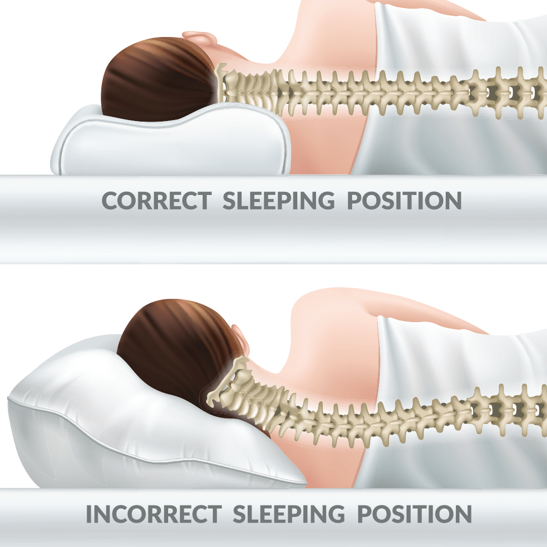 How To Live With Lower Neck Pain Or How Do You Live With Lower Neck Pain